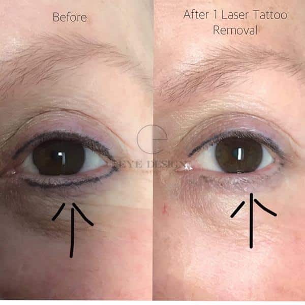How To Wash Off Eyeliner ? - My Glow Journey