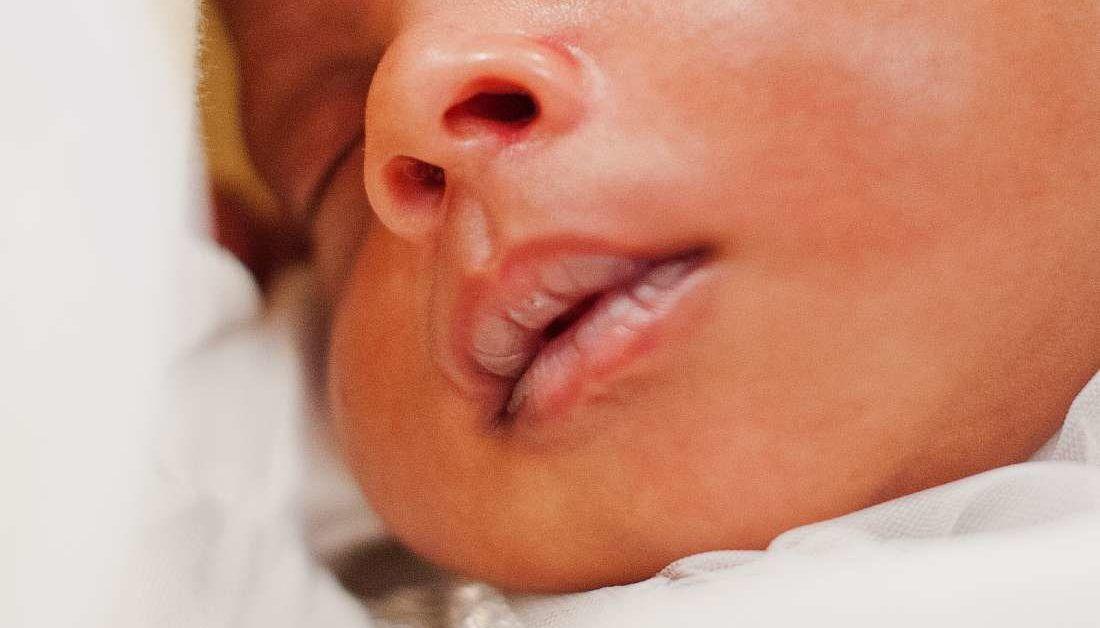 What To Put On Newborn Chapped Lips ? - My Glow Journey