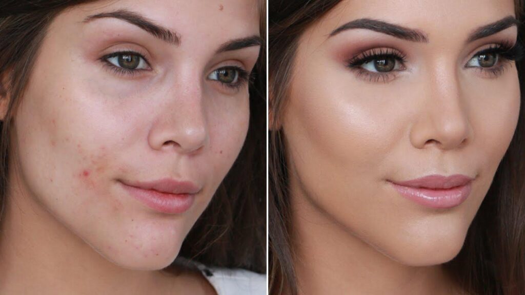 How To Cover A Zit With Makeup ? - My Glow Journey