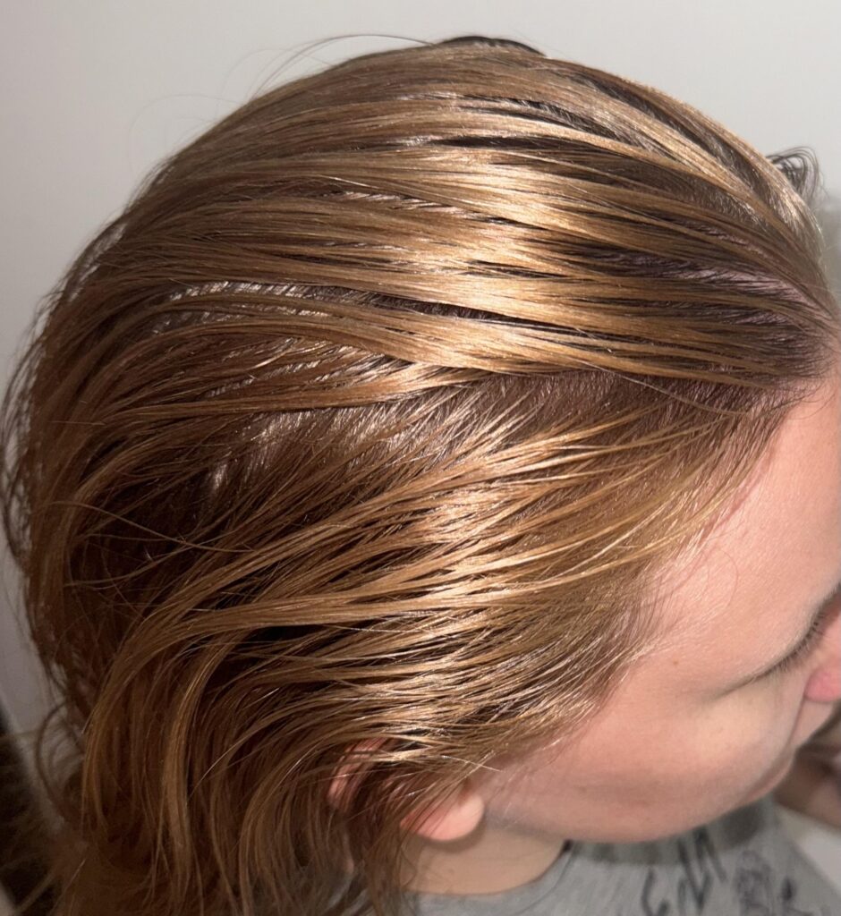 What Does Oily Hair Look Like ? - My Glow Journey